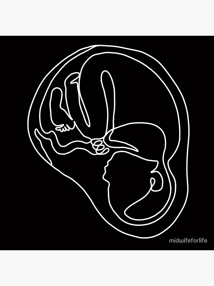"Fetus Lineart" Sticker for Sale by midwifeforlife | Redbubble