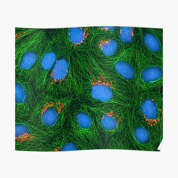 "HeLa Cancer Cell, Microscope Photo" Poster for Sale by ScienceSource ...