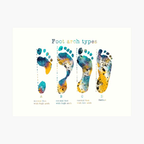 "Human types of footprints-foot arch types" Art Print for Sale by ...