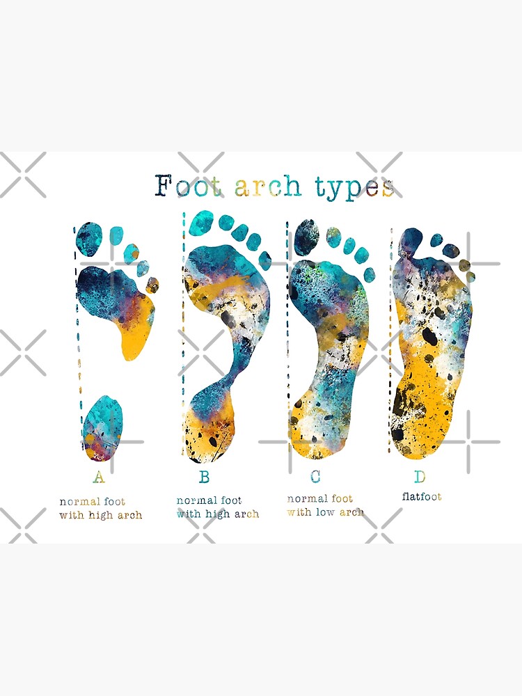 "Human types of footprints-foot arch types" Poster for Sale by ...