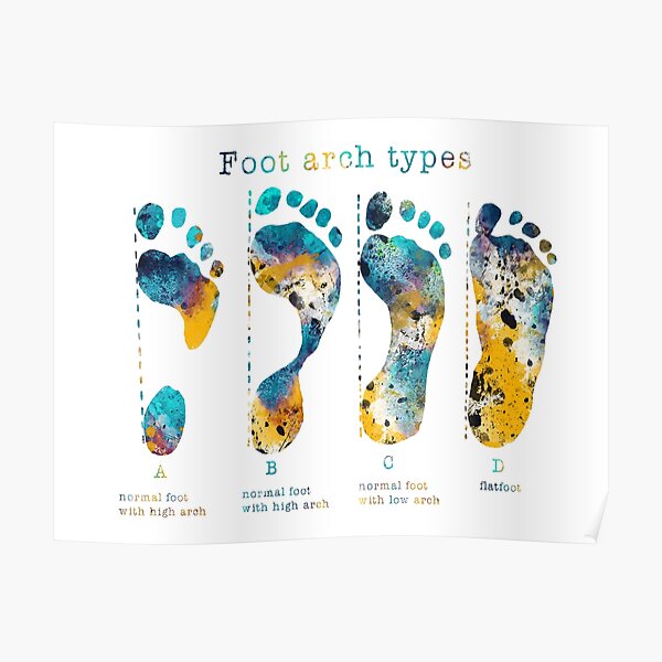 "Human types of footprints-foot arch types" Poster for Sale by ...