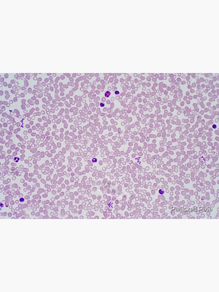 "CBC/ Whole Blood Count" Poster for Sale by bookworm7201 | Redbubble