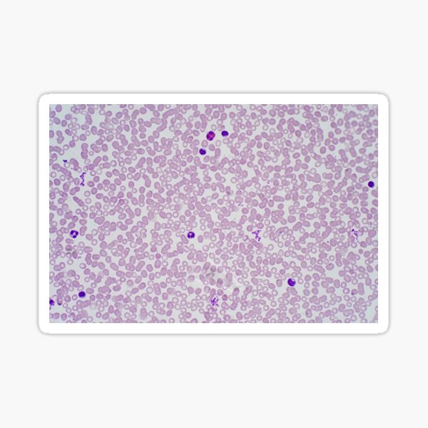 "CBC/ Whole Blood Count" Sticker for Sale by bookworm7201 | Redbubble