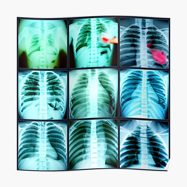 "Radiology / Radiography art" Poster for Sale by CinderPress | Redbubble