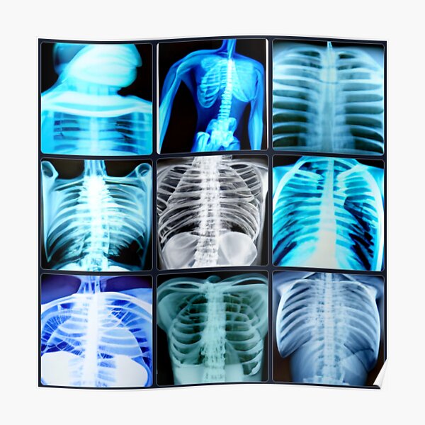 "Radiology / Radiography // X-ray art" Poster for Sale by CinderPress ...