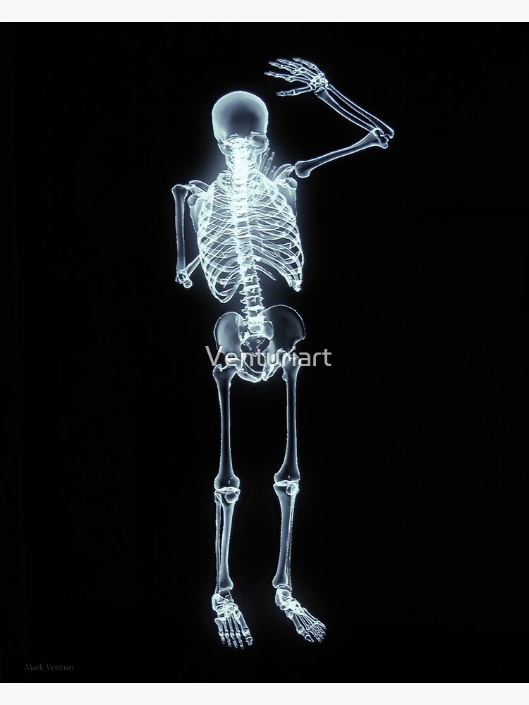 "Skeleton X-Ray" Sticker for Sale by Venturiart | Redbubble
