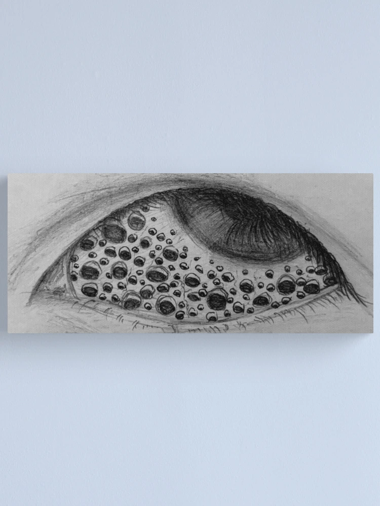 Trypophobie Oculaire