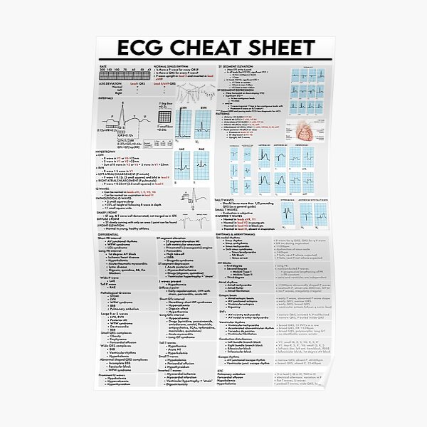 "ECG Cheat Sheet Cardiologist " Poster for Sale by ALISONABBOTTAU ...