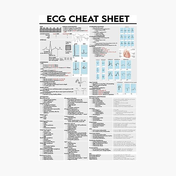 "ECG Cheat Sheet Cardiologist " Photographic Print for Sale by ...