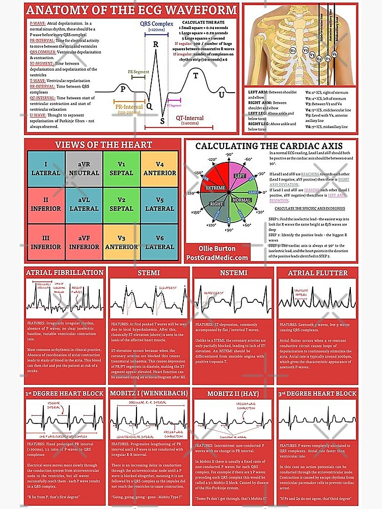 "ECG Waveform Cardiologist " Poster for Sale by AndinoYake | Redbubble