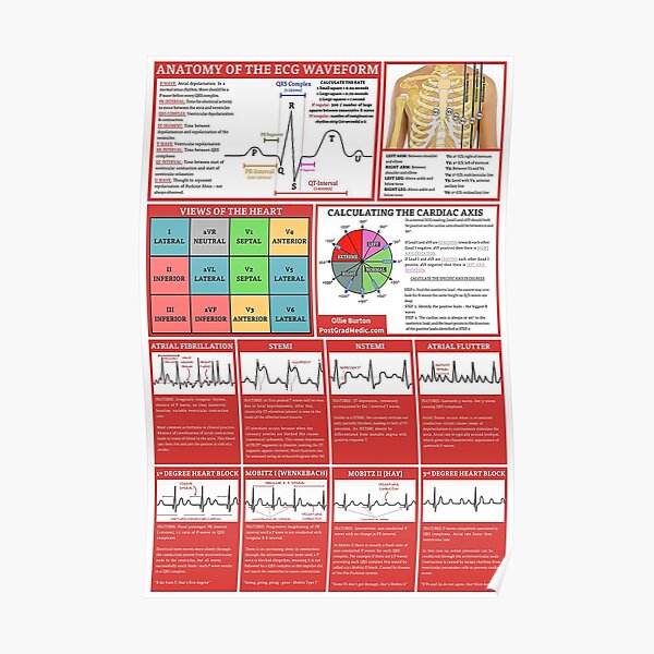 "ECG Waveform Cardiologist " Poster for Sale by AndinoYake | Redbubble