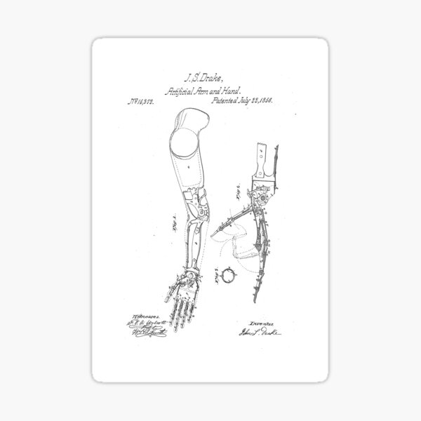 "1856 Prosthetic Arm " Sticker for Sale by oandpmemes | Redbubble