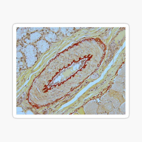 "Artery - Orcein stain" Sticker for Sale by DamGerry | Redbubble