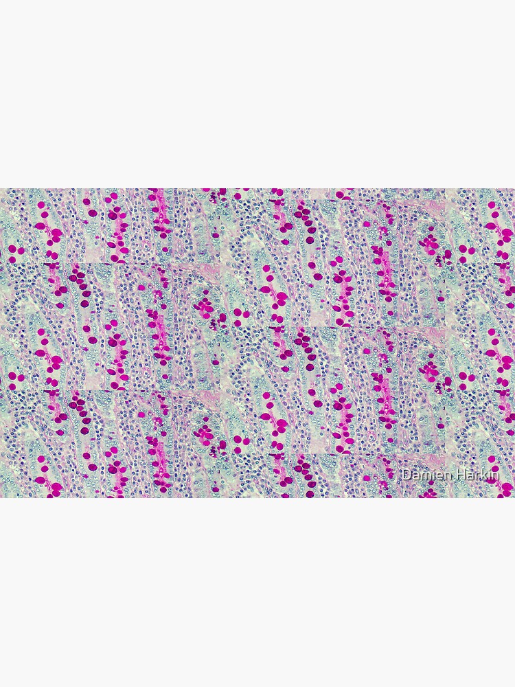 "Colon - PAS stain" Coffee Mug for Sale by Damien Harkin | Redbubble