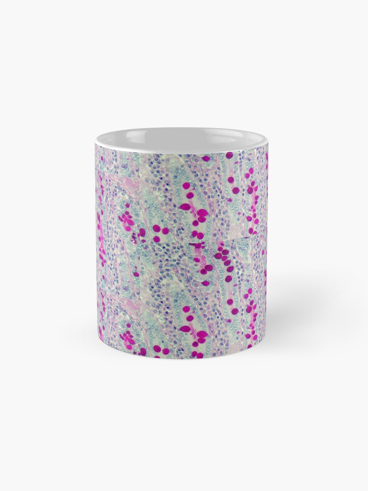 "Colon - PAS stain" Coffee Mug for Sale by Damien Harkin | Redbubble
