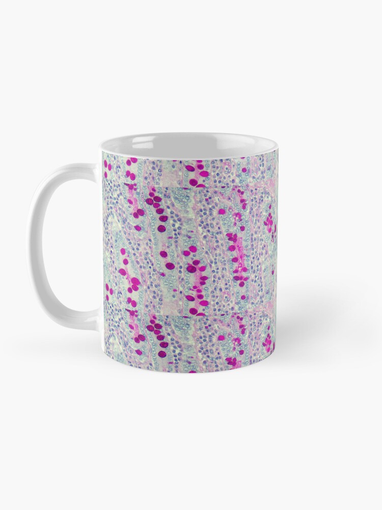 "Colon - PAS stain" Coffee Mug for Sale by Damien Harkin | Redbubble