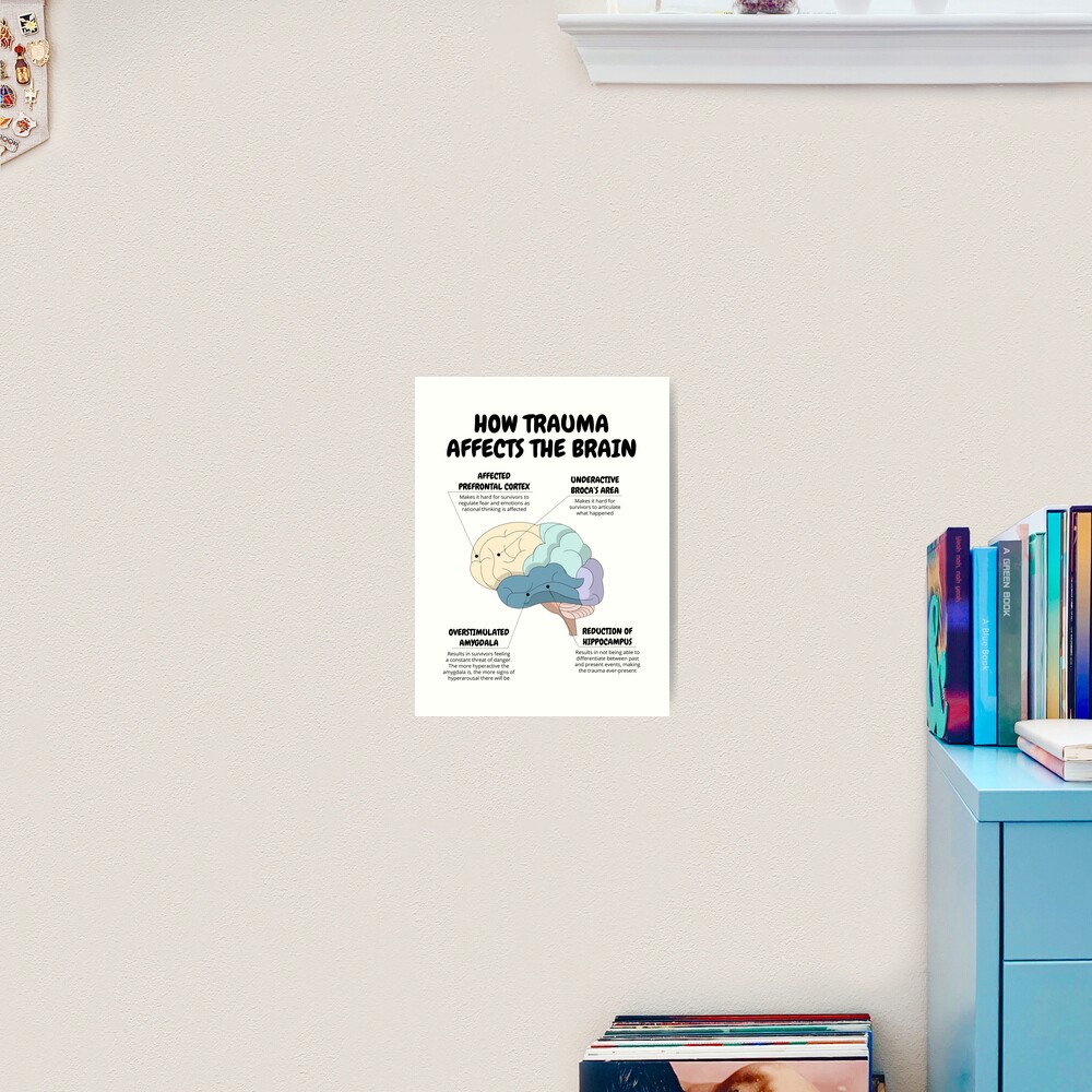 "How Trauma Affects The Brain Therapist Office Decor PTSD Recovery CBT ...
