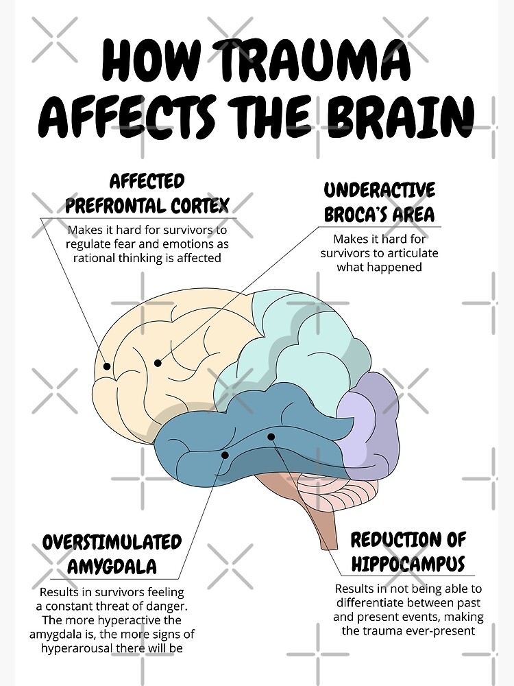 "How Trauma Affects The Brain Therapist Office Decor PTSD Recovery CBT ...