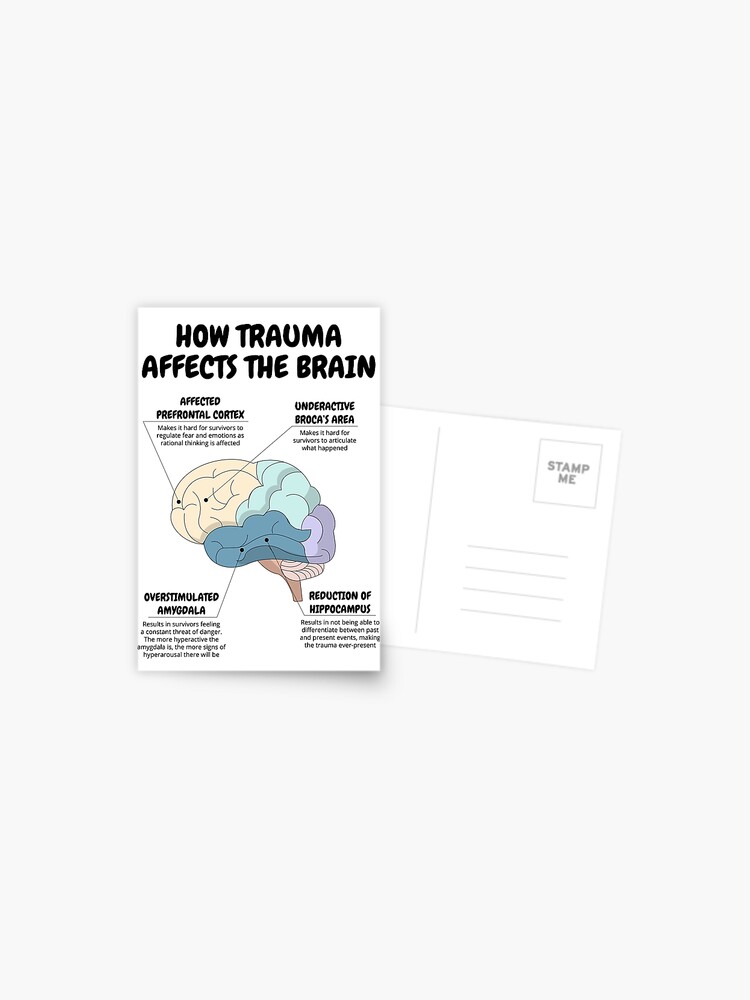 "How Trauma Affects The Brain Therapist Office Decor PTSD Recovery CBT ...