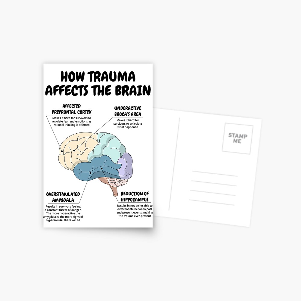 "How Trauma Affects The Brain Therapist Office Decor PTSD Recovery CBT ...