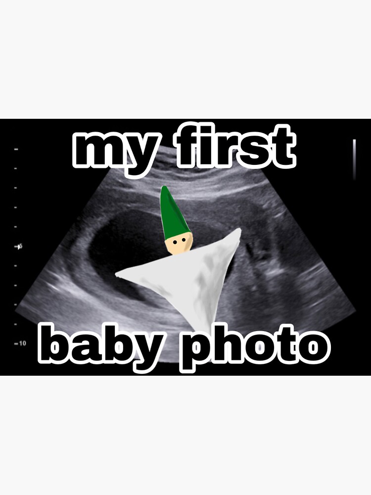 "Me As A Baby meme" Sticker for Sale by literallycraft | Redbubble