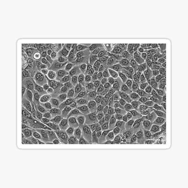 "Corneal epithelial cells" Sticker for Sale by Damien Harkin | Redbubble