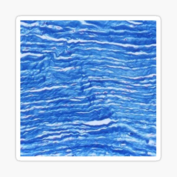 Tendon Gifts & Merchandise for Sale | Redbubble