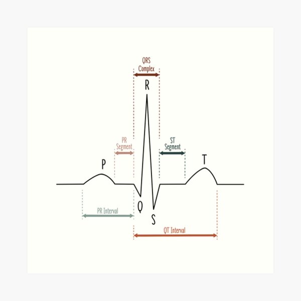 "Anatomy of an EKG" Art Print for Sale by hannahswank | Redbubble