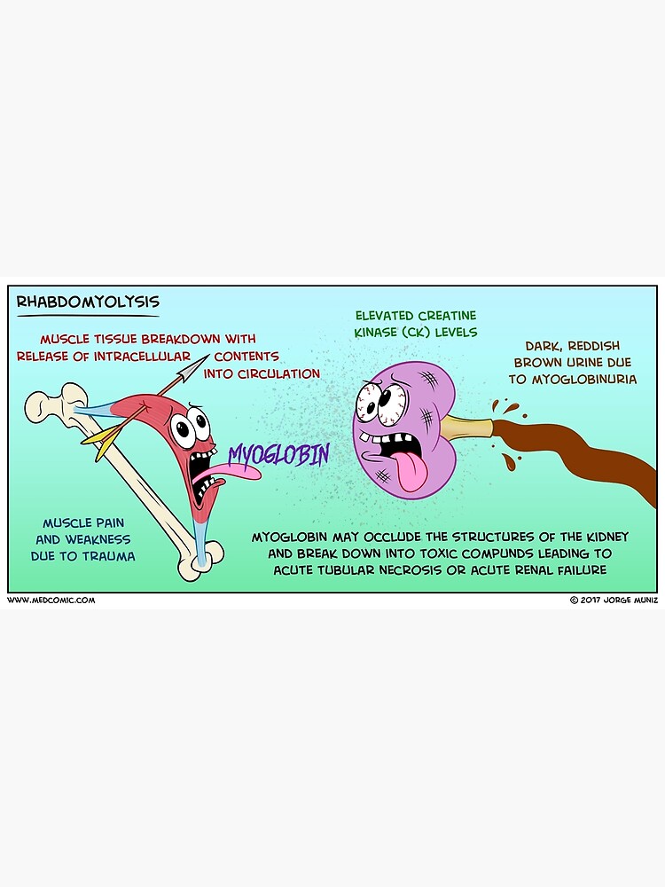 Póster «Rabdomiólisis» de Medcomic | Redbubble