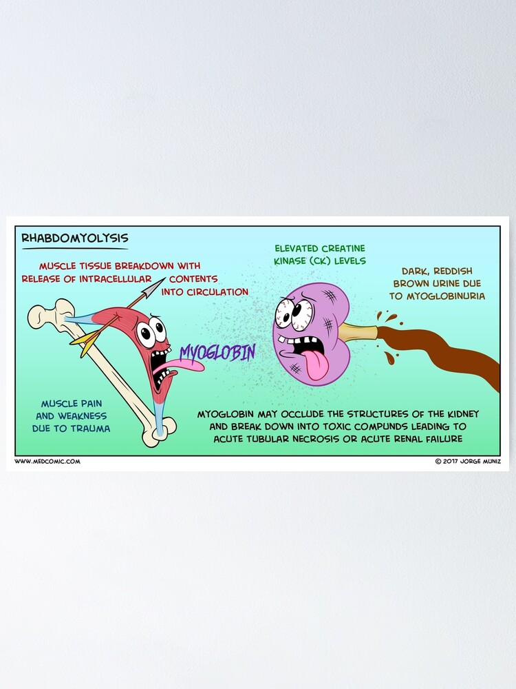 "Rhabdomyolysis" Poster for Sale by Medcomic | Redbubble