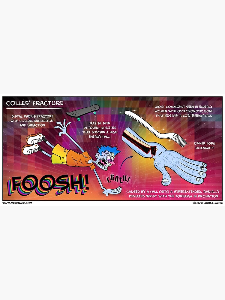 "Colles’ Fracture" Poster for Sale by Medcomic | Redbubble