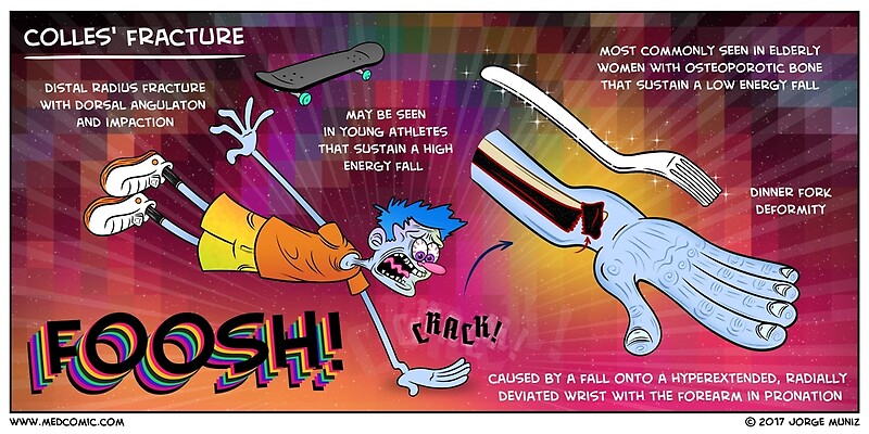 "Colles’ Fracture" by Medcomic | Redbubble