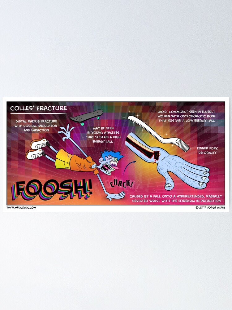 "Colles’ Fracture" Poster for Sale by Medcomic | Redbubble