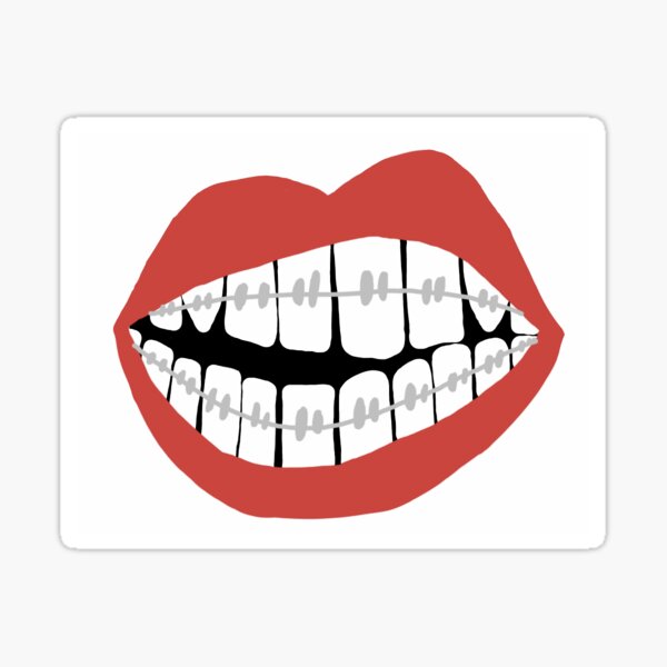 "Brace Face" Sticker for Sale by catlady1o1 | Redbubble