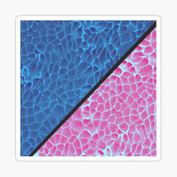 "Blue and pink epithelial cells under the microscope" Sticker for Sale ...