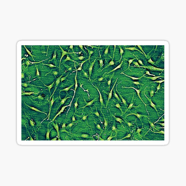 "Corneal stromal cells - Forest Green LUT" Sticker for Sale by Damien ...