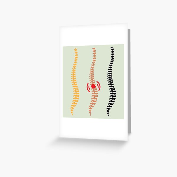 Spine Surgery Greeting Cards | Redbubble