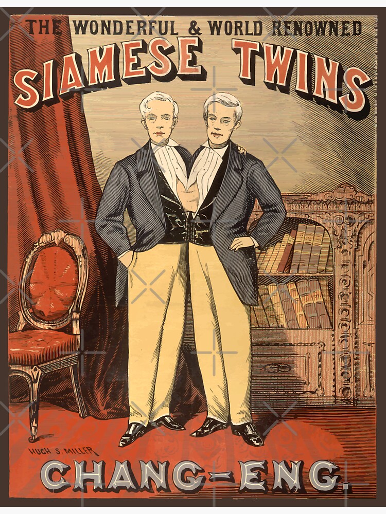 "Siamese twins poster from the 1800s" Sticker for Sale by monsterplanet ...