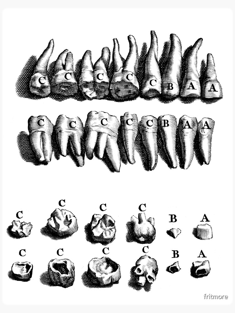 "medieval anatomical drawing of extracted human teeth" Sticker for Sale ...