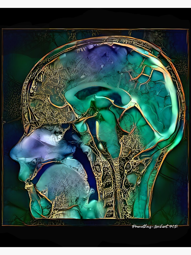 "Brain Anatomy - Green Hulk Edition" Sticker for Sale by ArtofLionhart ...