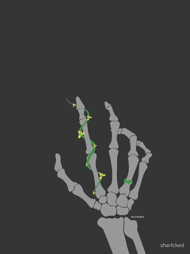 "Corpse Bride Skeleton Hand" iPhone Case for Sale by sherlcked | Redbubble