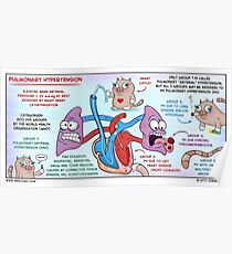 Pulmonary Posters | Redbubble