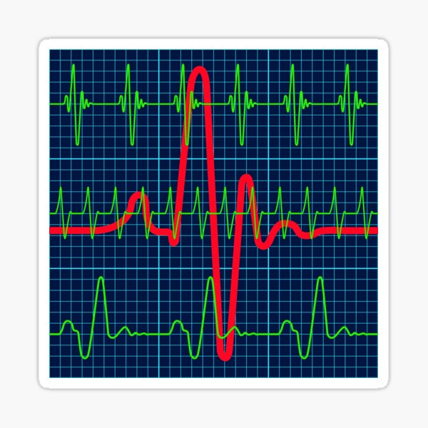 "Cardiogram charts pattern" Sticker for Sale by AlexanderZam | Redbubble
