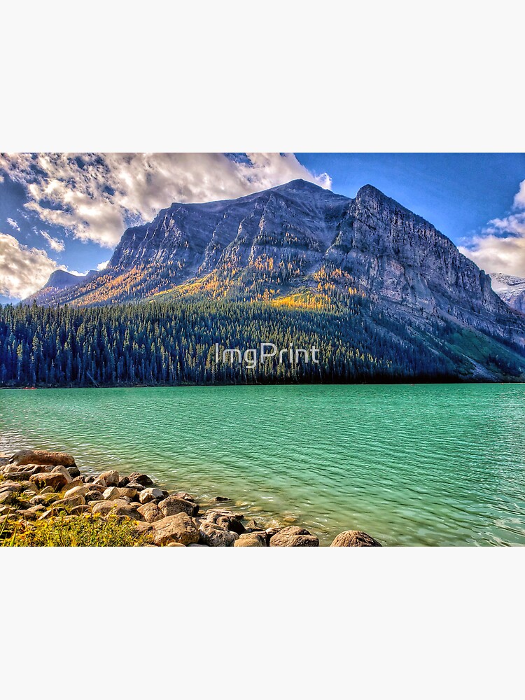 " Fairmont Chteau Lake Louise" Sticker for Sale by artdigitly | Redbubble