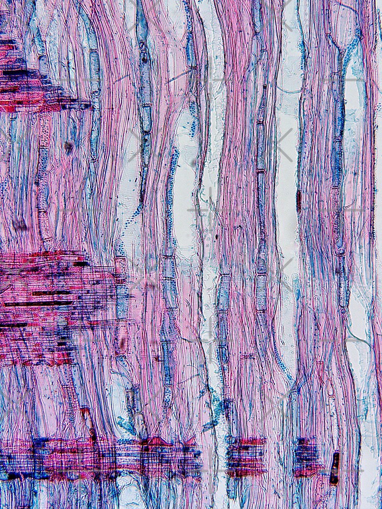 "pear tree, wood cells, radial section; plant anatomy, microscopy ...
