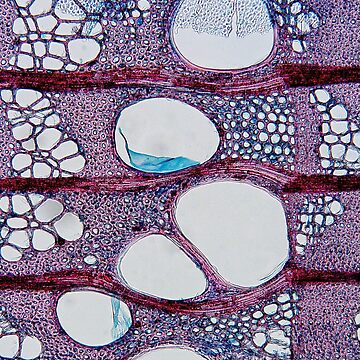 "ash tree, wood cells, cross section; plant anatomy, microscopy ...