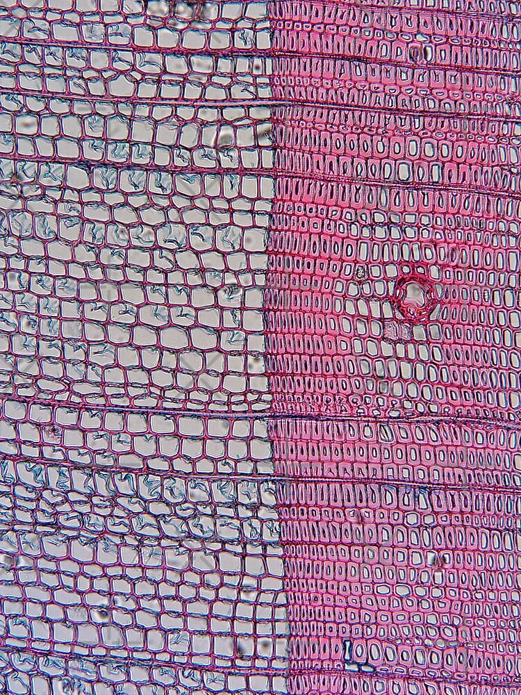 "spruce tree, wood cells, cross section; plant anatomy, microscopy ...