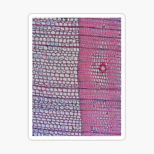 "spruce tree, wood cells, cross section; plant anatomy, microscopy ...