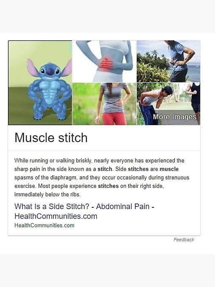 "muscle stitch" Sticker for Sale by MemeOfTheCrop | Redbubble