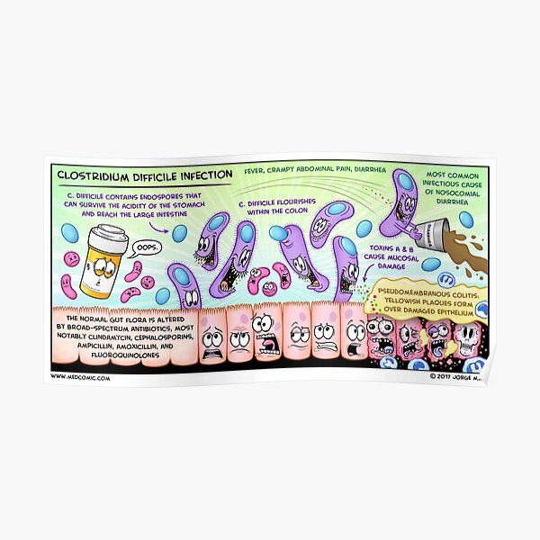 "Clostridium difficile Infection" Poster for Sale by Medcomic | Redbubble